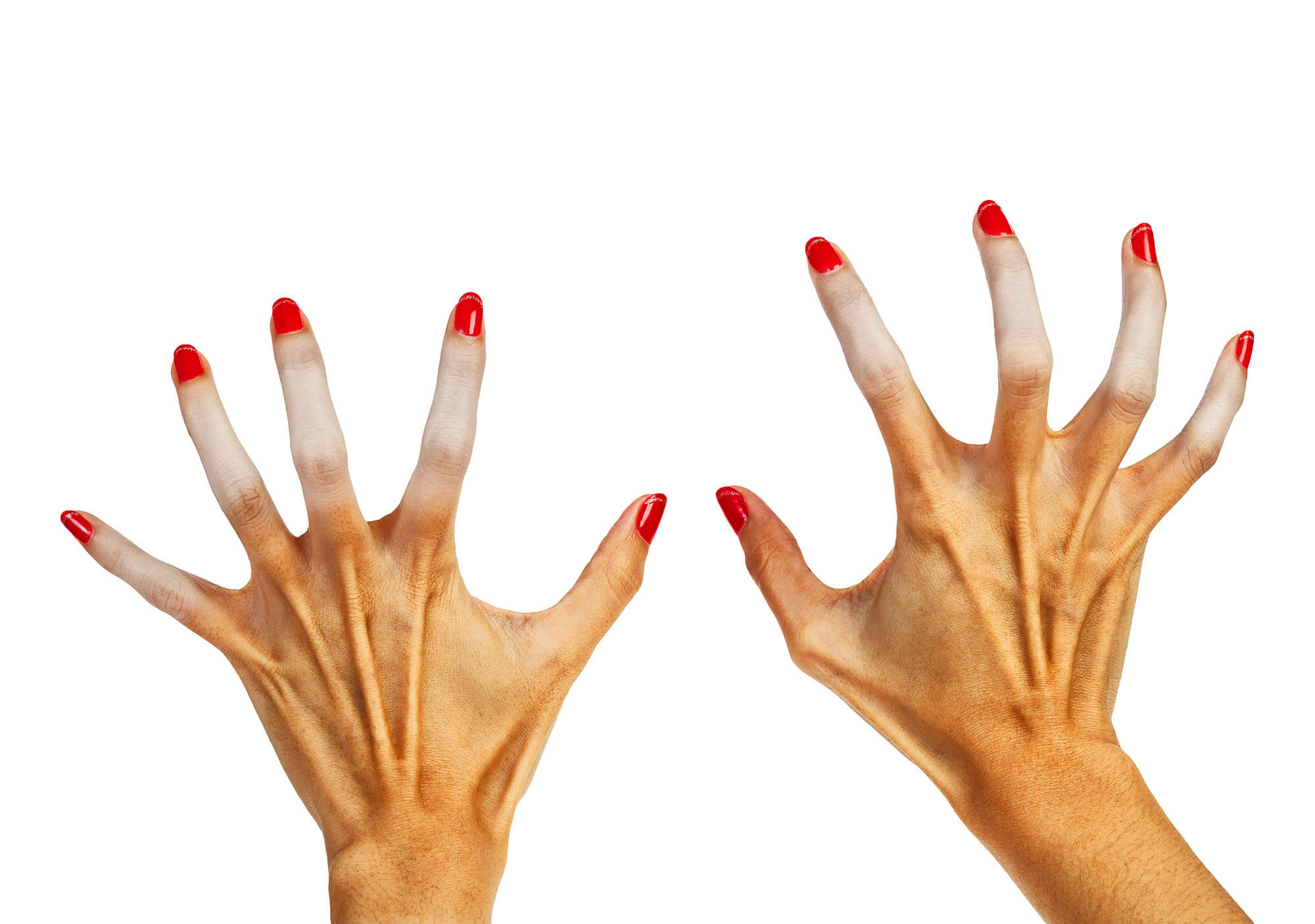 16 situations que seules les personnes qui souffrent de la maladie de ...