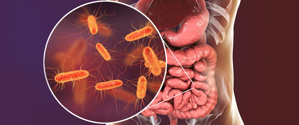 10 complications possibles de la maladie de Crohn